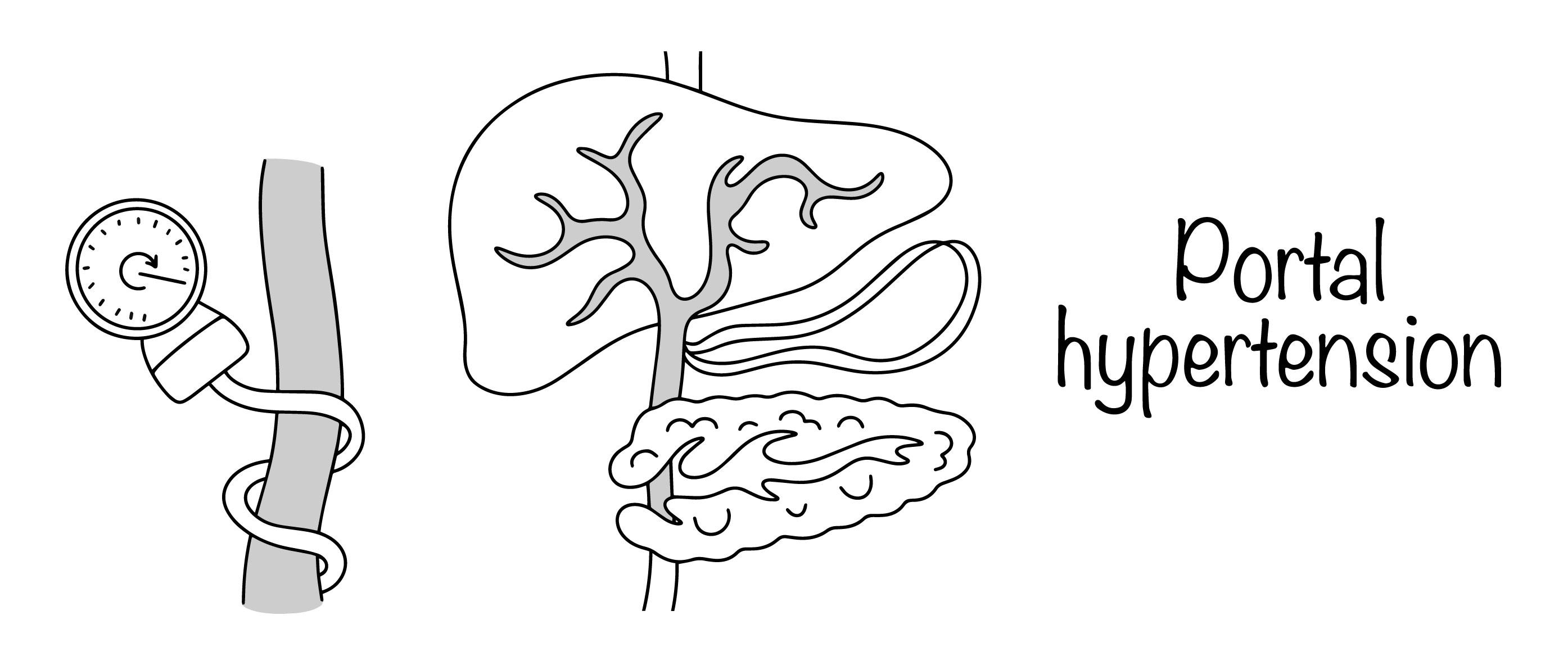 J. Bosch, Liver Unit, University Clinic for Visceral Surgery and ...